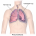 Pneumothorax – Symphyse Pleurale - Chirurgie thoracique Hop. Bichat